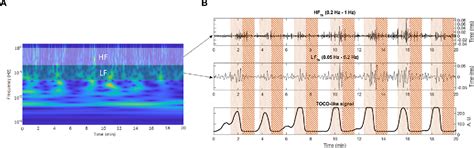 Figure 2 From Uterine Activity Modifies The Response Of The Fetal Autonomic Nervous System At