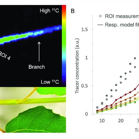 Comparison Of Reconstruction Algorithms Mlem And Osem Using Different Download Scientific