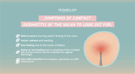 Vulva Itching And Rash Treatment at Mary Reilly blog