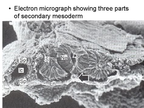 Neurulation Differentiation Of Mesodermal Layer Paraxial Mesoderm