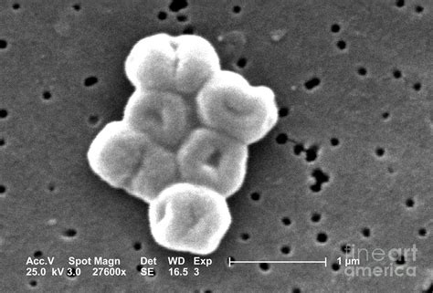 Acinetobacter Baumannii Sem 6 Photograph By Science Source Pixels Merch
