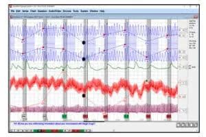 Polygraph Testing Chart Cincinnati Polygraph Associates