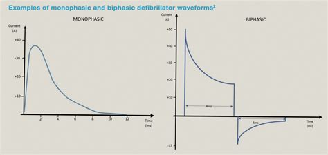 Physical Principles Of Defibrillators Anaesthesia And Intensive Care Medicine