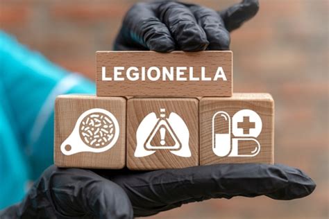 7 Useful Tips From Experts In Legionella Risk Urisk