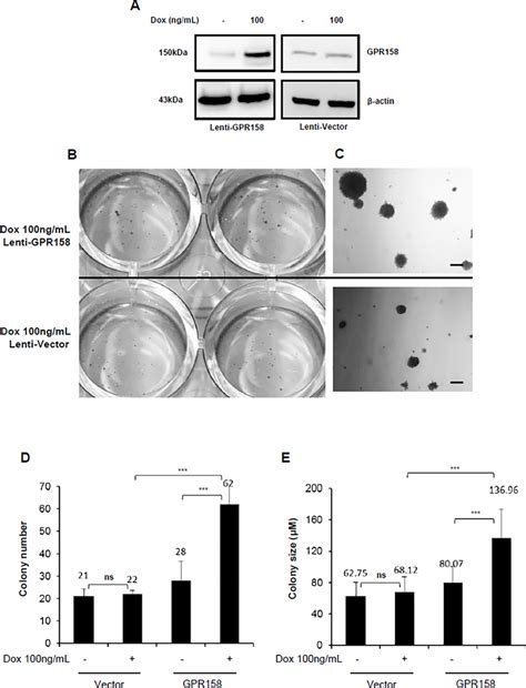 Gpr158 Effects On Anchorage Independent Colony Formation In Lncap Download Scientific Diagram