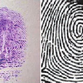 Whorl Pattern Impression And Diagrammatic Representation Download Scientific Diagram