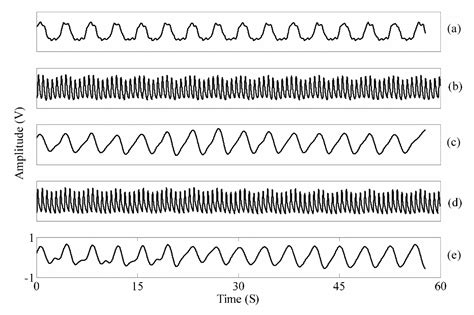 Figure 4 From Extraction Of Respiratory Activity From Ppg And Bp