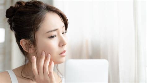 How To Get Rid Of Pimple Marks At Home Remedies Beauty Tips By Nim