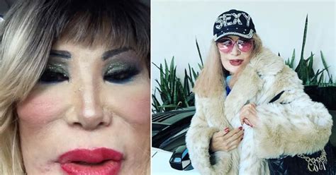 La Triste Tragedia Dietro Al Volto Di Lyn May