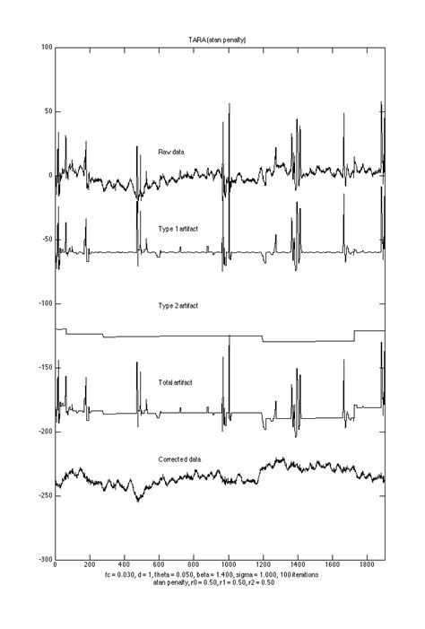 Taraexample2 Transient Artifact Reduction Algorithm Tara