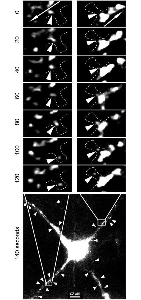 Translocation Of Small Puncta Into Spines Neurons 1012 Div Were