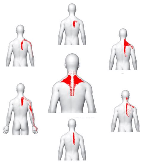 Myofascial Trigger Point Therapy In New York City