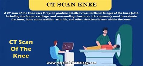 Ct Scan Of Knee