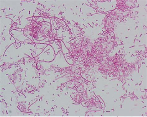 Actinomyces Pyogenes