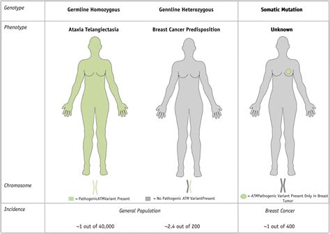 Atm Variants In Breast Cancer Implications For Breast Radiation
