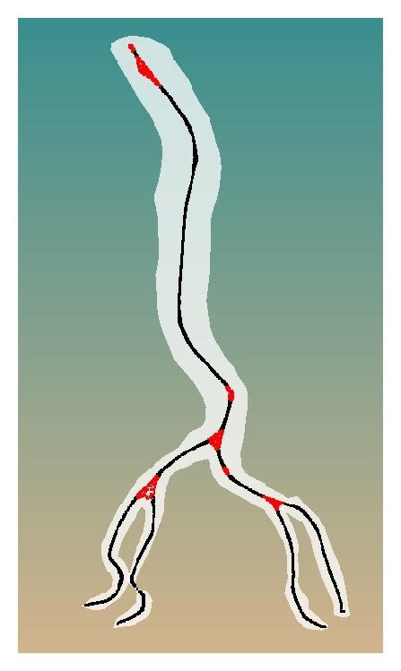 The Procedure Of Centerline Extraction Method From A To D Are The