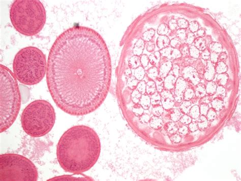 Nematodes Did You Feel That Biology 201