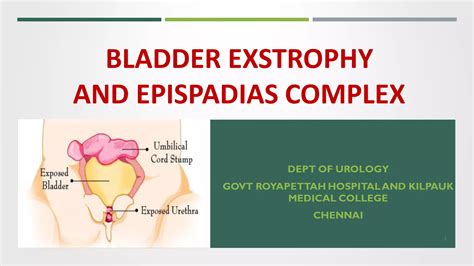Pediatric Urologybladder Extrophy And Epispadias Complex Pdf
