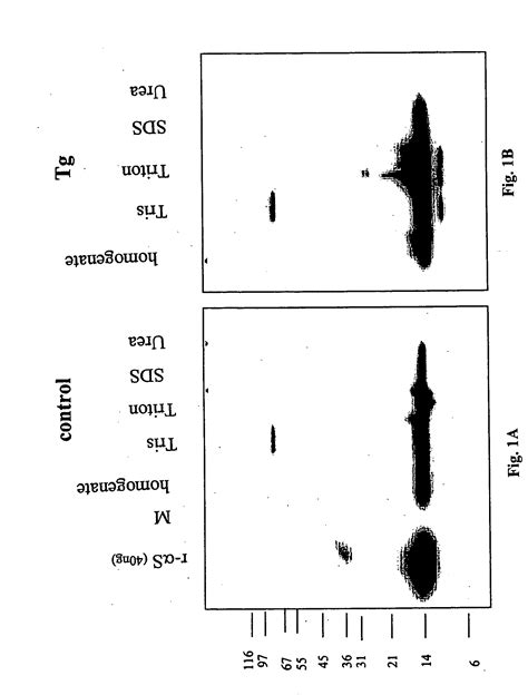 Lewy Body Disease Patented Technology Retrieval Search Results Eureka Patsnap