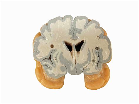 Brain Coronal Sections HUMAN ANATOMY WEB SITE