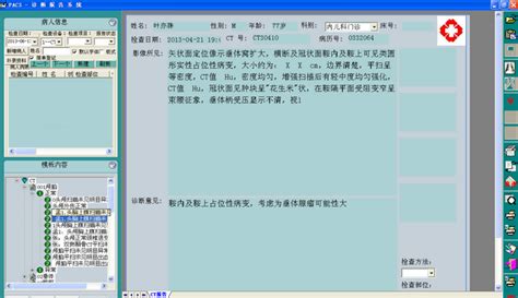 Ris Pacs系统源码 Cs架构的综合应用系统 自主知识产权 知乎