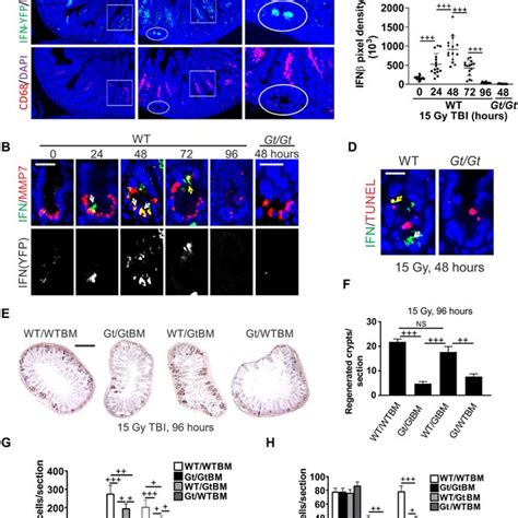 Sting Ifn B Drives Reparative Inflammation After Tbi Survival And The