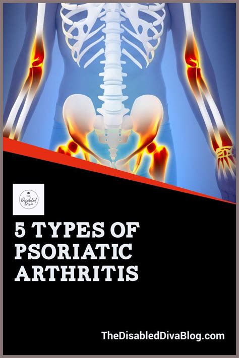 Do You Know Your Psoriatic Arthritis Type Why You Need To Find Out