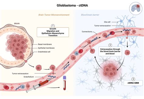 Brain Tumor Progression Glioblastoma By Liquid Biopsy Biorender Science Templates