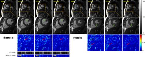 Deep Low Rank Prior In Dynamic Mr Imaging