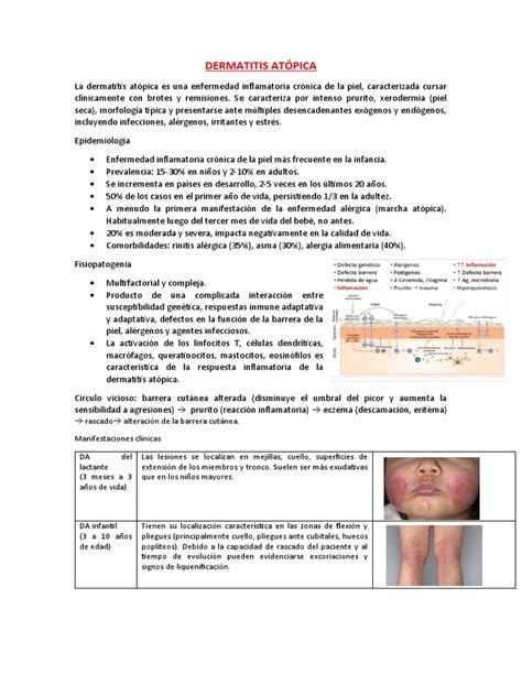 Dermatitis Atópica Pdf Alergia Inflamación