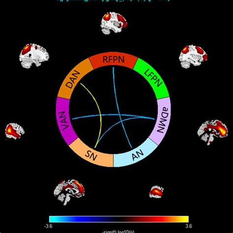 Significant Result From Intra Network Functional Connectivity Group