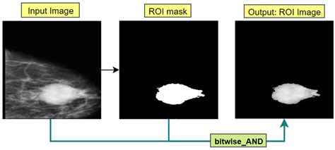Biology Free Full Text An Effective Ensemble Machine Learning Approach To Classify Breast