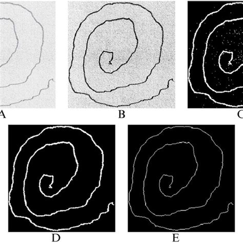 Pre Processing Of Spiral Drawings To Extract Movement A Original Download Scientific Diagram