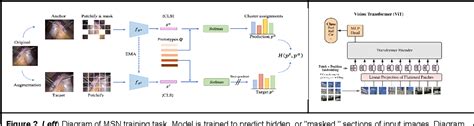 Figure 2 From Predicting Generalization Of Ai Colonoscopy Models To