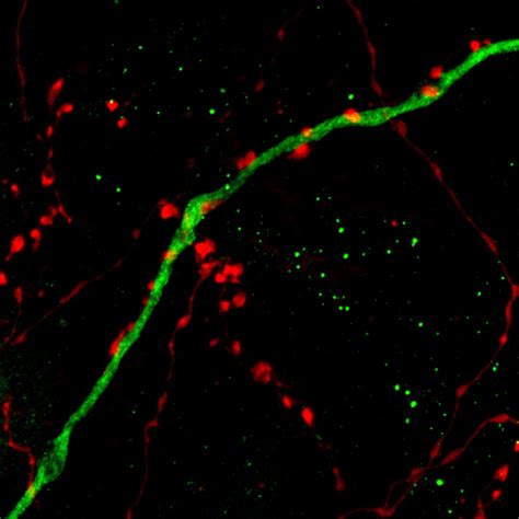 High Resolution Confocal Microscopy Hálózat Idegélettan Kutatócsoport Institute Of