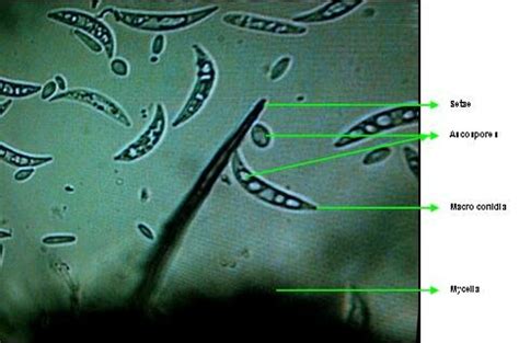 Common Features Of C Sublineolum Isolate Infecting Sorghum Bicolor Download Scientific Diagram