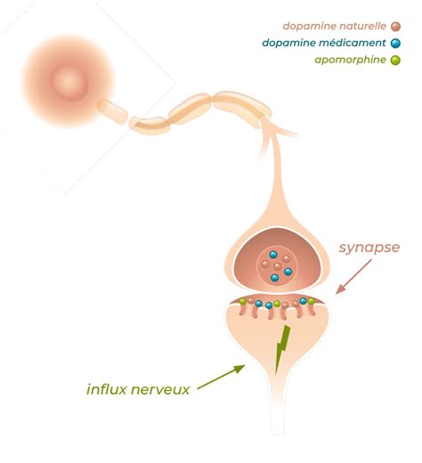 Parkinsuite Pompe à Apomorphine