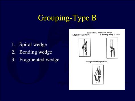 Ppt Fracture Classification Powerpoint Presentation Free Download Id 3349217