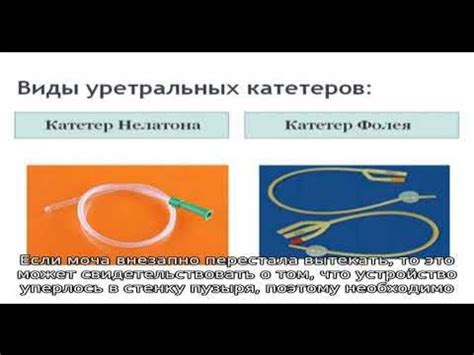 Катетер для выведения мочи - YouTube