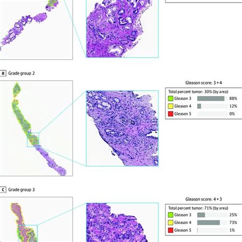 Illustrative Concept Of How Deep Learning System Dls Results May Be Download Scientific