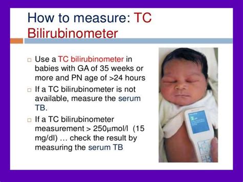 Neonatal Hyperbilirubinemia Bilirubinaemia Of Newbornpptx Ppt