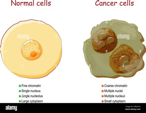 Cancer And Normal Cells Comparison And Difference Between Healthy