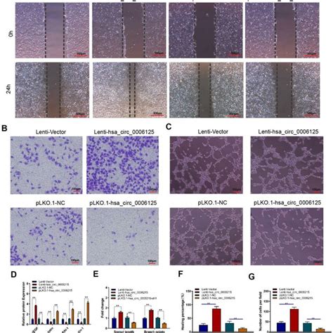 Circrna Hsa Circ 0006215 Promotes Angiogenesis Of Huvecs Effects Of Download Scientific