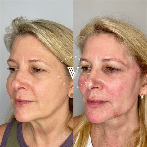 Pdo Threads Vamped Aesthetics