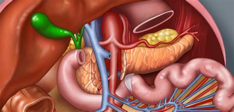 The Lap Chole Surgery In Detail
