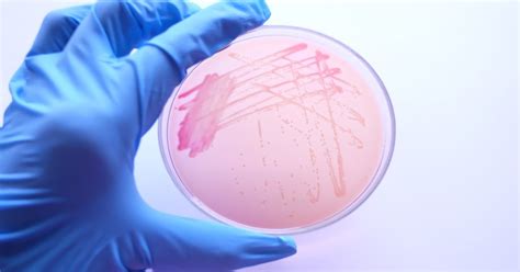 Threat Of Cronobacter Contamination For Powder Infant Formula Rings Clear In Latest Us Recall