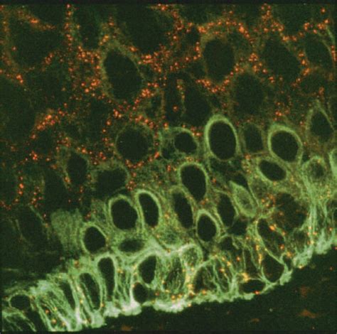 Multiple Antigen Immunostaining Procedures Pmc