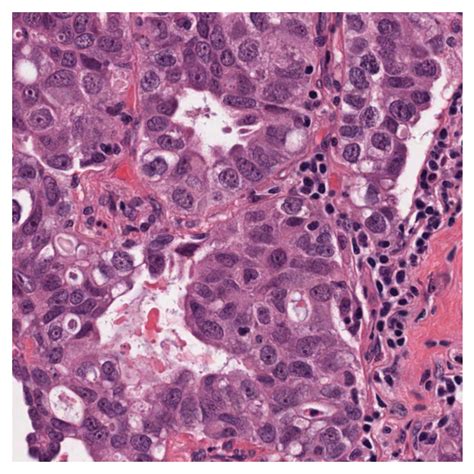 Stain Normalization Tia Toolbox 151 Documentation