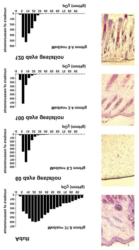 Pooled Oxygen Partial Pressure Histograms Of Adult And Fetal Dermal