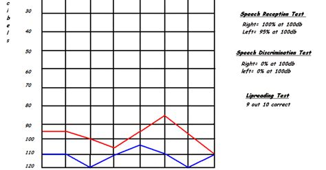 Welcome To Picture Of My Audiogram